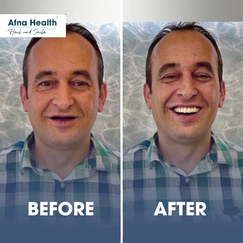 HOME - AFNA HEALTH TURKEY