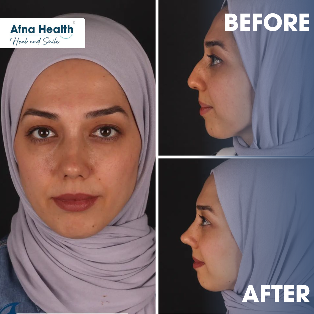 HOME - AFNA HEALTH TURKEY