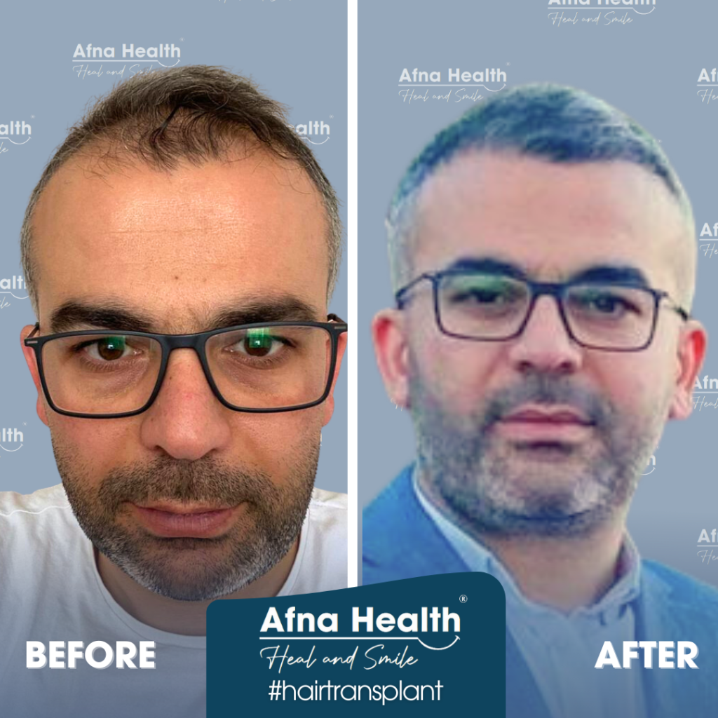 HOME - AFNA HEALTH TURKEY